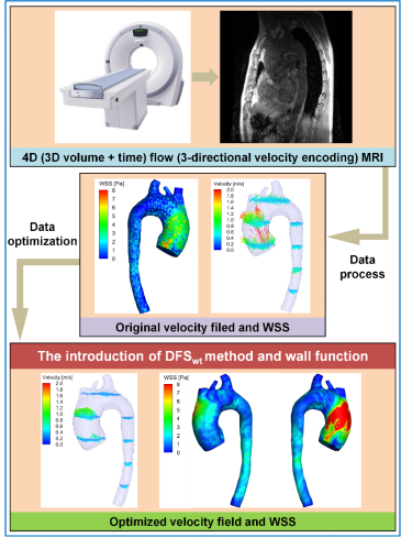 4D flow MRI在大血管的应用研究 - 杭州晟视科技有限公司